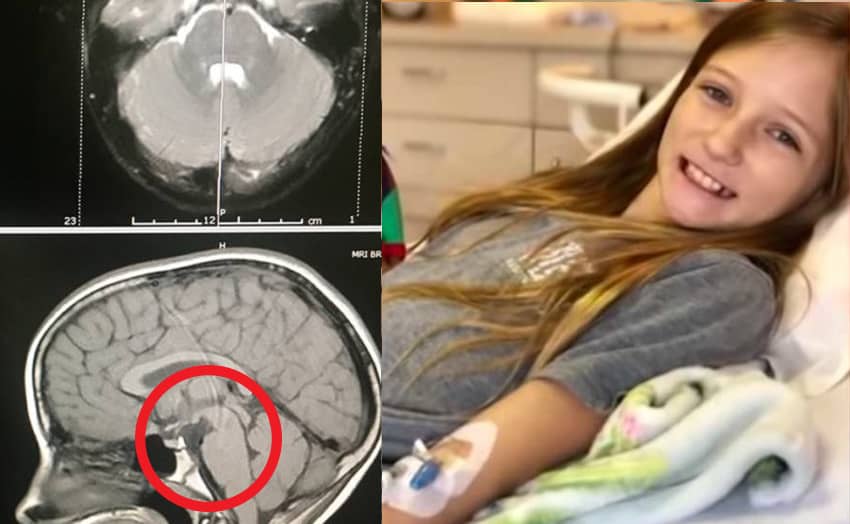 Doctors Baffled When 11-year-old Girl’s Inoperable Brain Tumor ...
