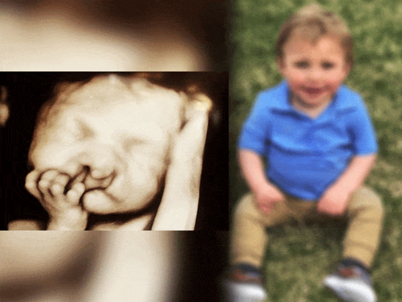 Parents Refused Doctor’s Advice To Abort ‘Deformed’ Baby - Look at Him ...