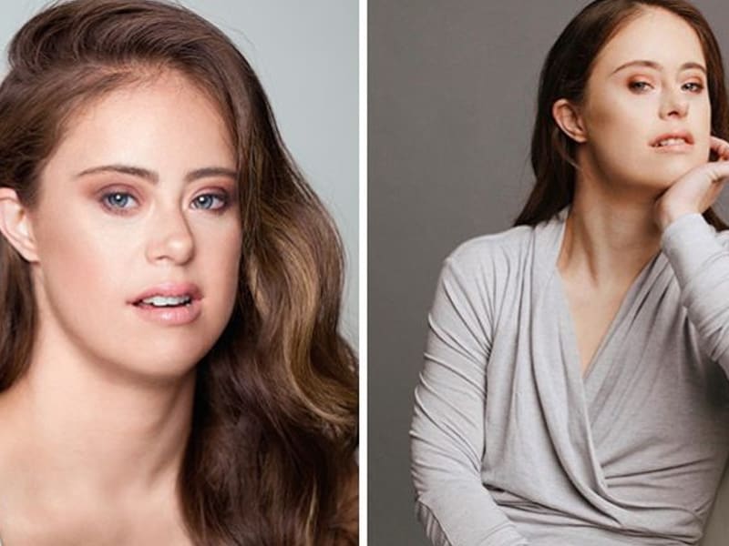 Chelsea Werner Defies Down Syndrome Stereotypes | Christian Learning & News