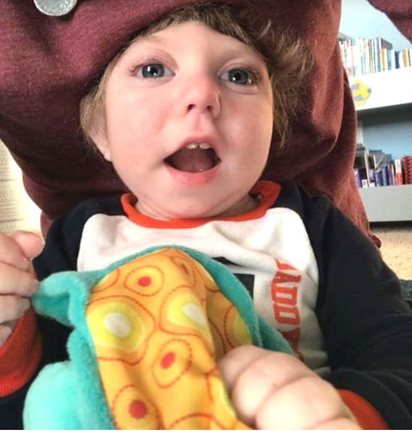 Missing Skull Miracle | Baby reaches third birthday with no skull ...