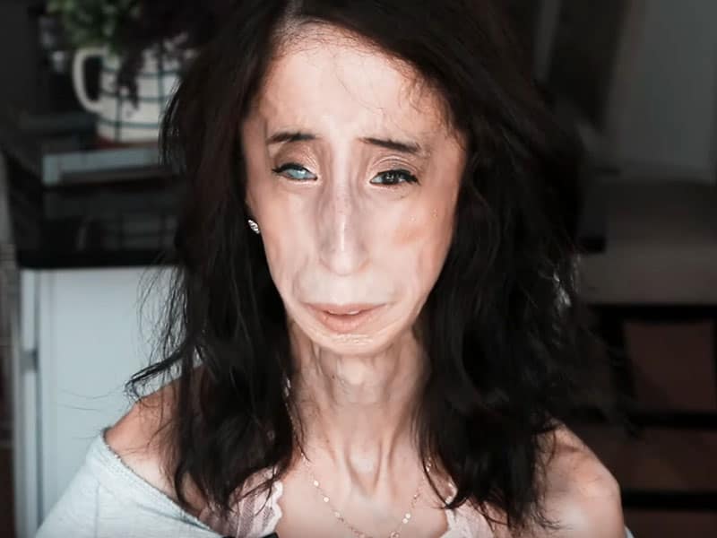 Lizzie, Labeled The 'World's Ugliest Woman', Was Lost Until She Watched ...