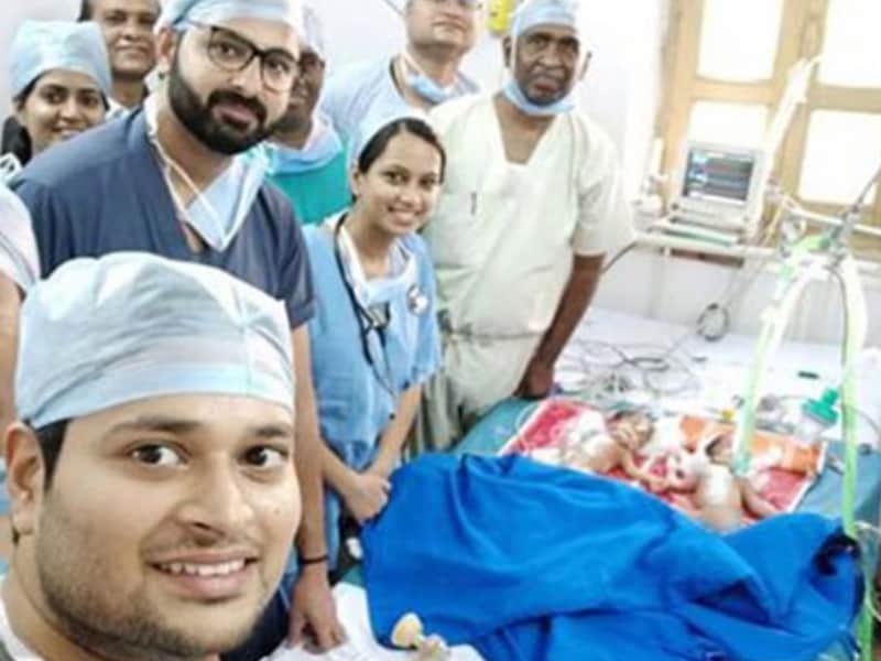 Conjoined Twins In Need Of Separation Receive A Miracle | Christian ...