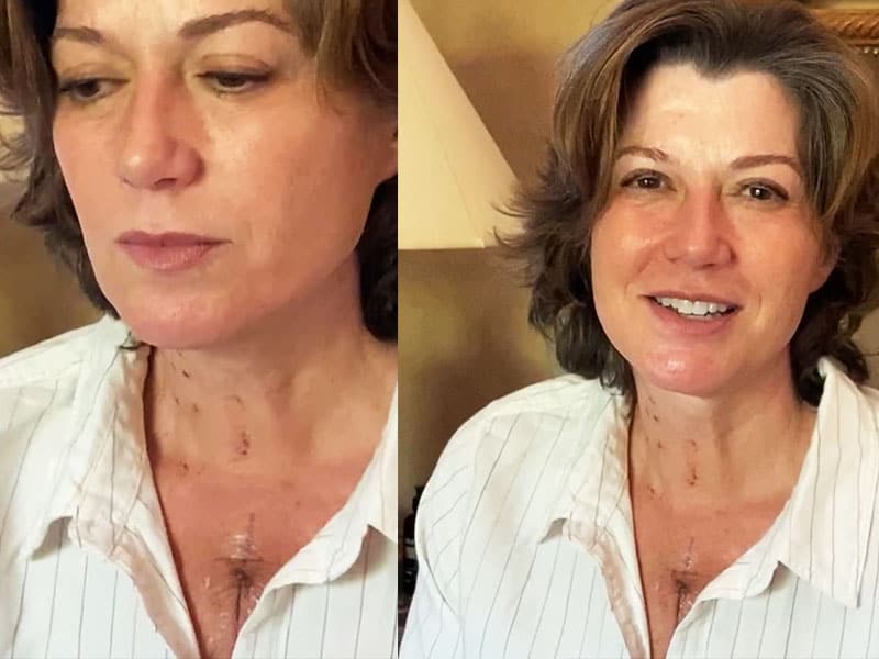Amy Grant After Open Heart Surgery: It 'Felt Miraculous' | Christian ...