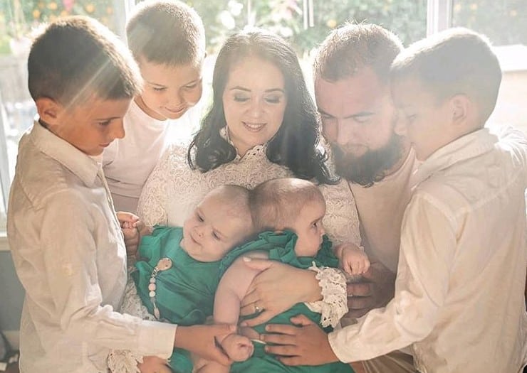 Parents Praise God After 9-Month-Old Conjoined Twin Daughters Are ...