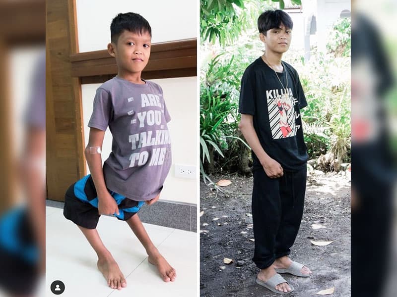 Boy Born With Feet Backwards Can Now Walk Straight—Tim Tebow Testifies ...