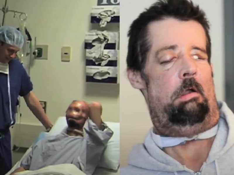 He Calls Losing His Face From Terrible Accident A “Gift From God ...