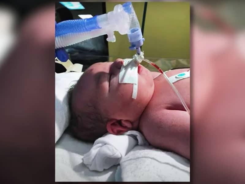 Mother Gives Birth To Baby Without Heartbeat, 23 Minutes Later A ... Mother Gives Birth To Baby Without Heartbeat, 23 Minutes Later A ...