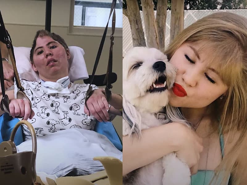 Horrific Car Crash Victim Was Told She Wouldn’t Survive But God ...